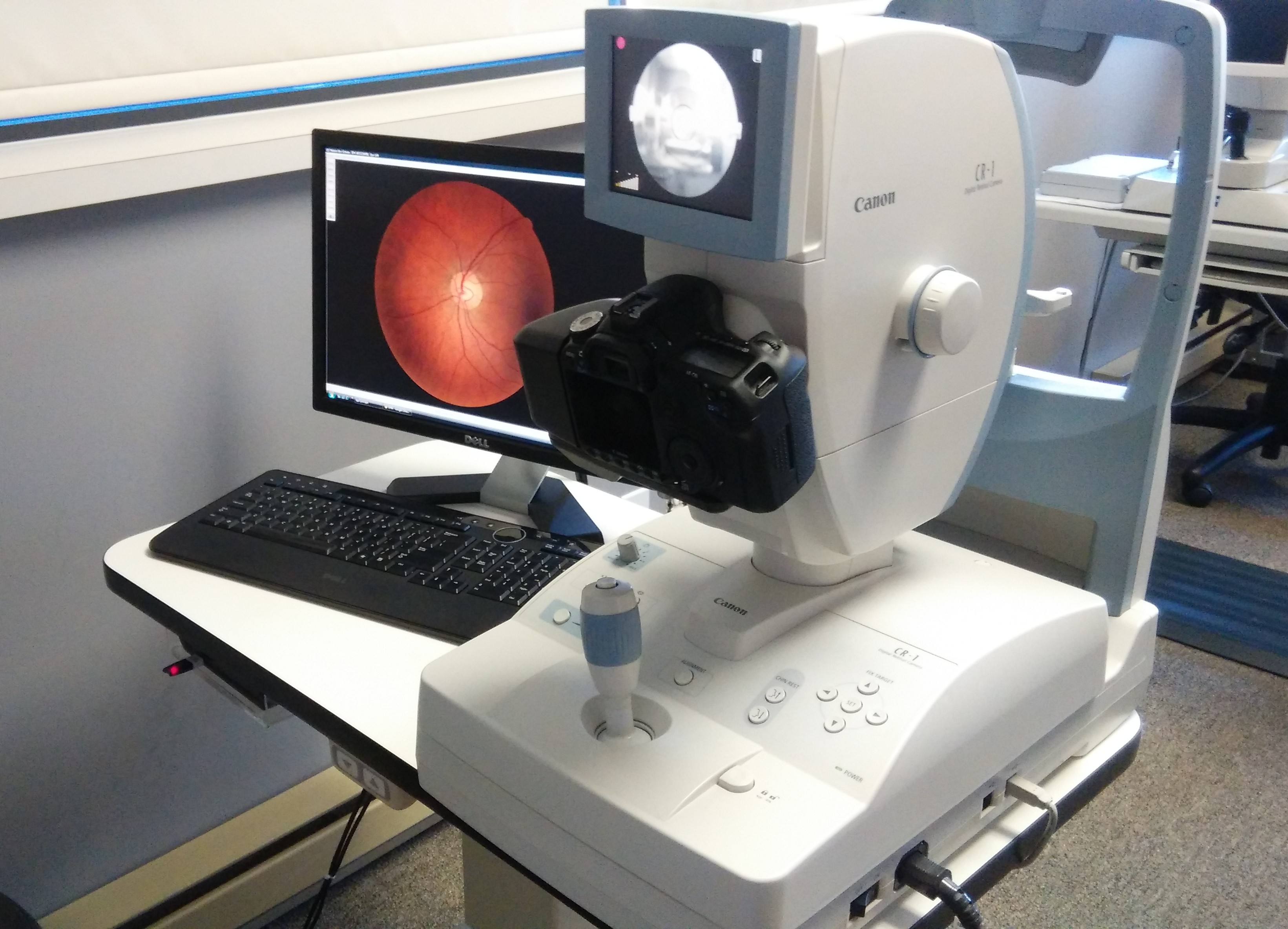 Diabetic Eye Screening at the Ocular Health Centre – Ocular Health Network